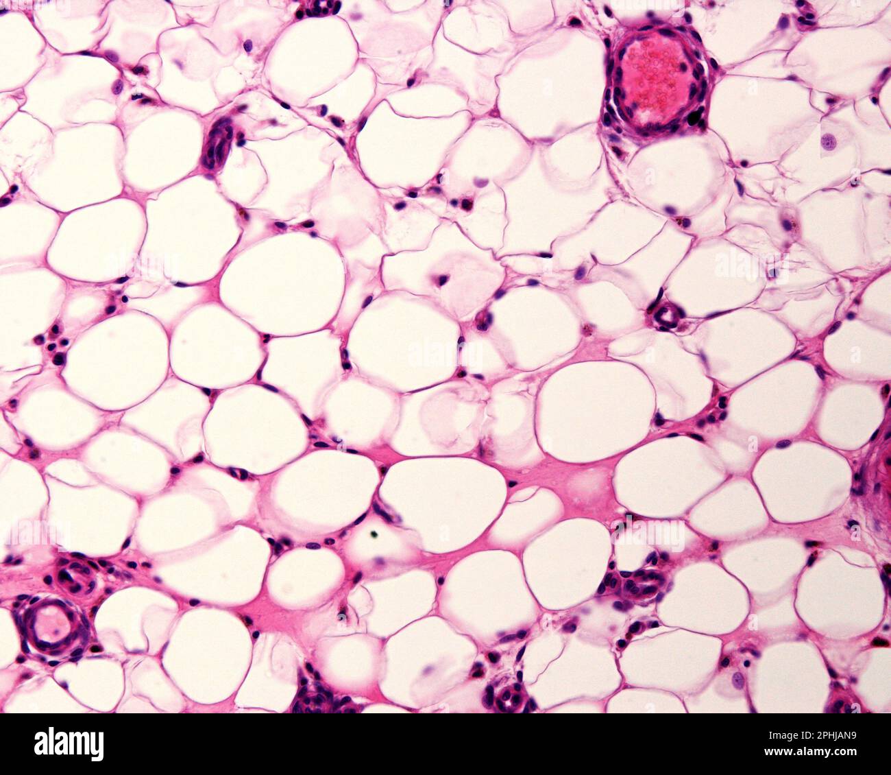 Adipose tissue, light micrograph Stock Photo - Alamy