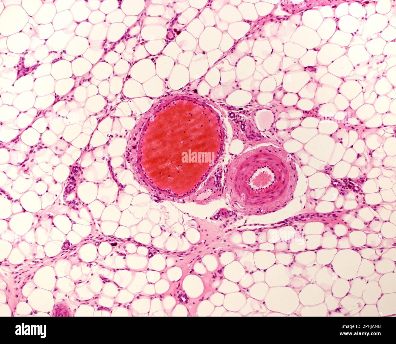 Adipose Under Microscope