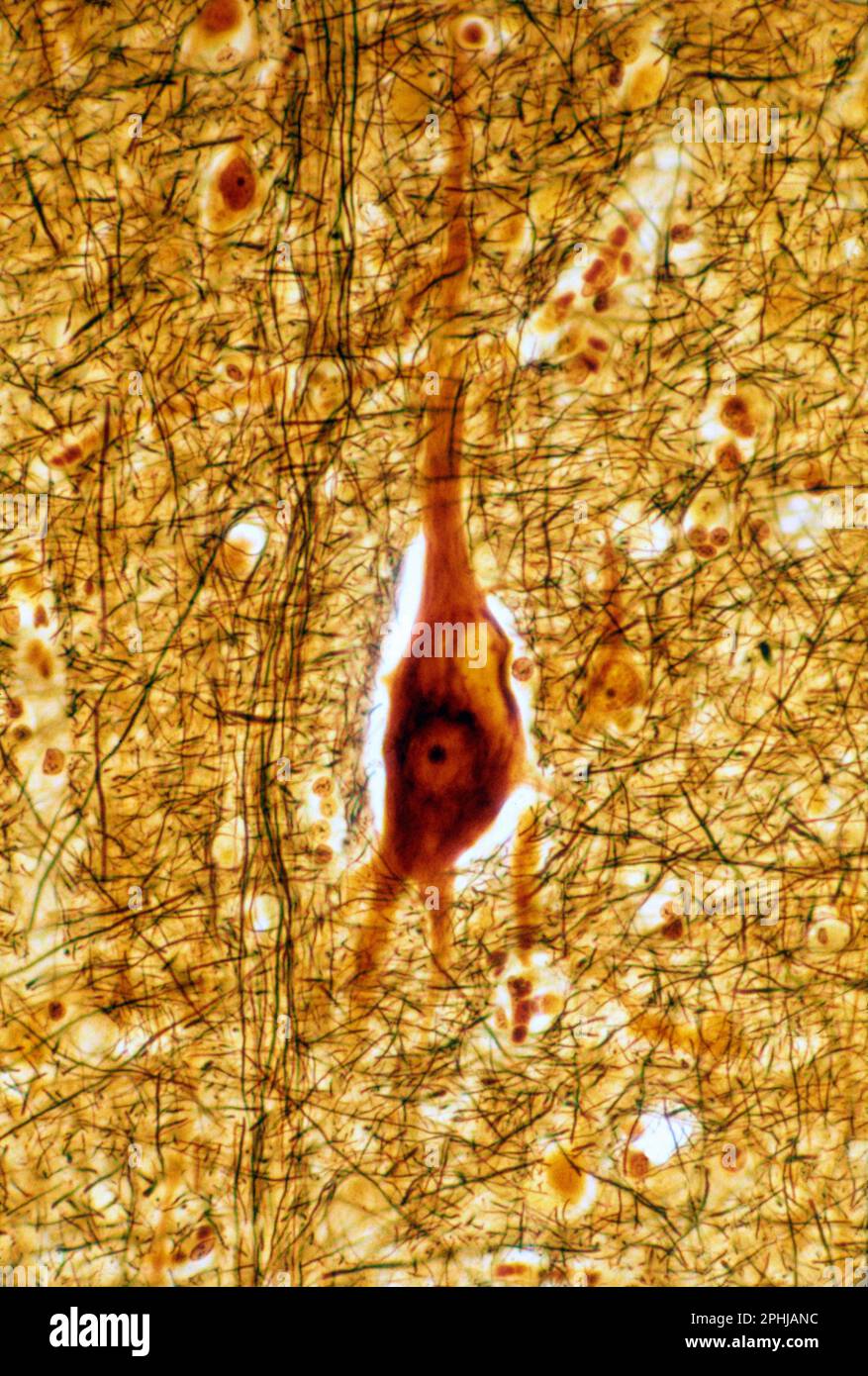 Lipofuscin in pyramidal neuron, light micrograph Stock Photo - Alamy