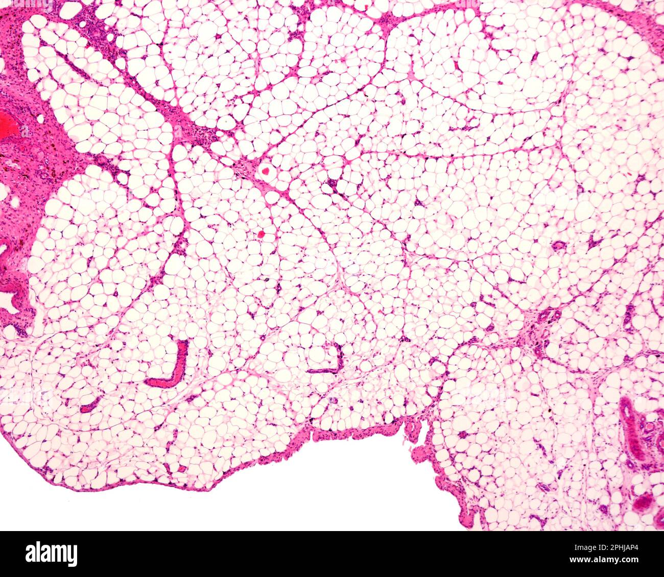 White adipose tissue, light micrograph Stock Photo - Alamy