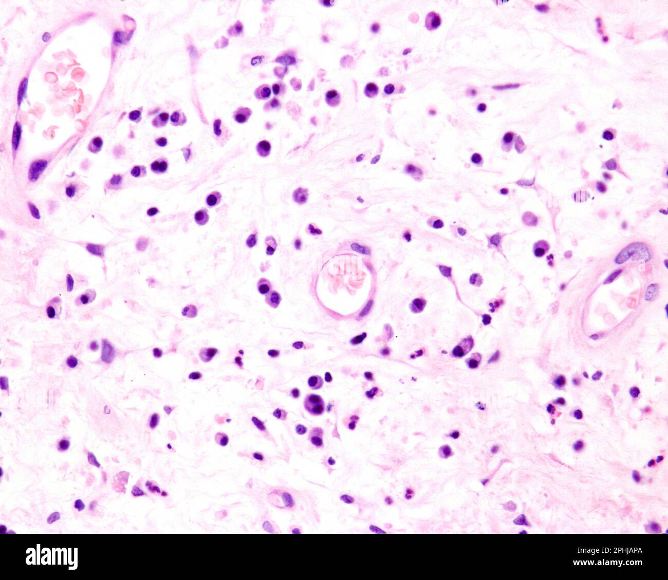 Plasma cells, light micrograph Stock Photo - Alamy