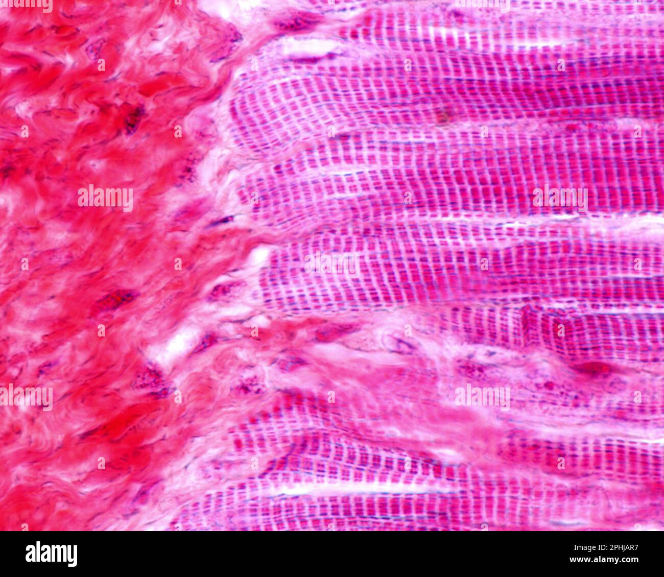 Myotendinous junction, light micrograph Stock Photo - Alamy