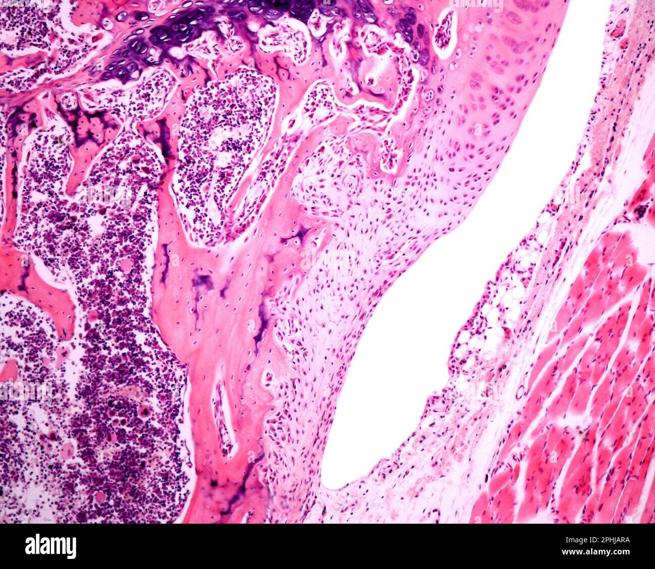 Joint synovial membrane, light micrograph Stock Photo - Alamy