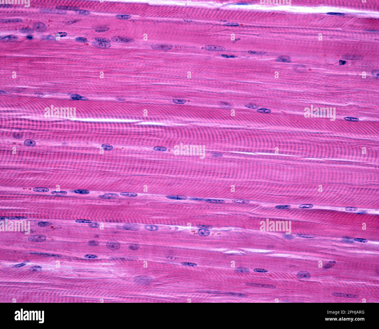 Skeletal striated muscle, light micrograph Stock Photo - Alamy