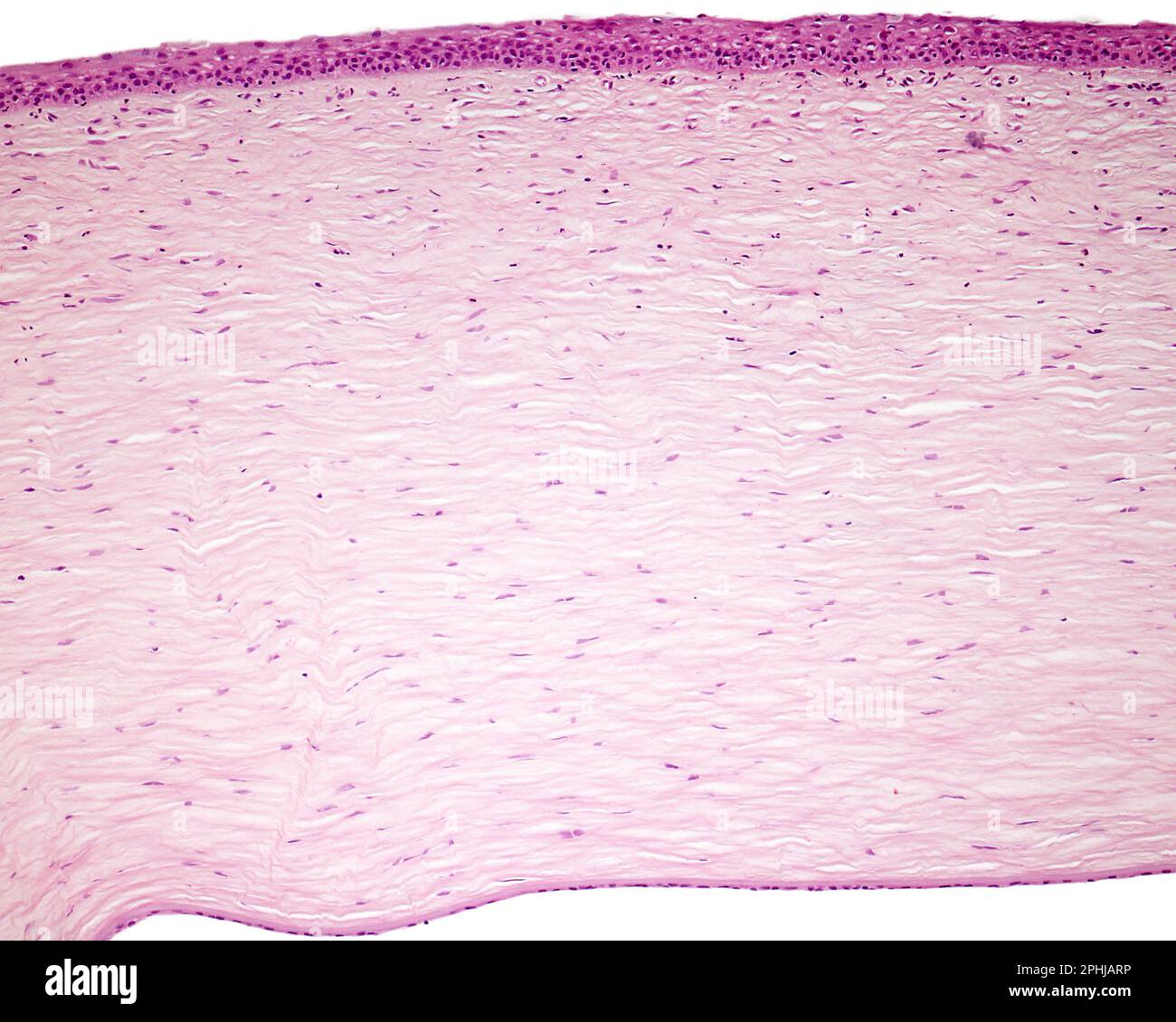 Human cornea, light micrograph Stock Photo - Alamy