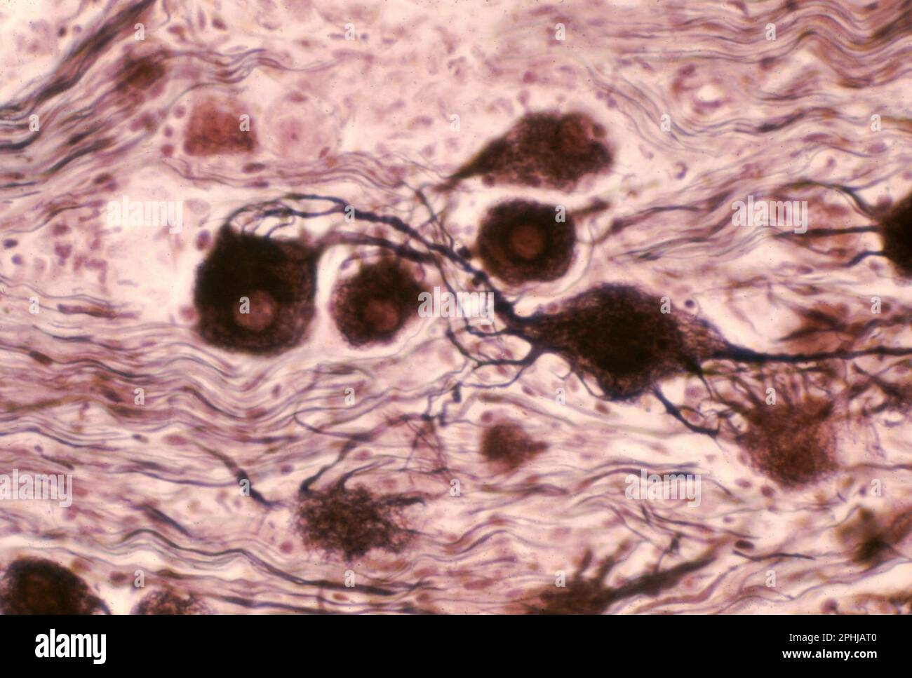 Autonomic ganglion neurons, light micrograph Stock Photo - Alamy