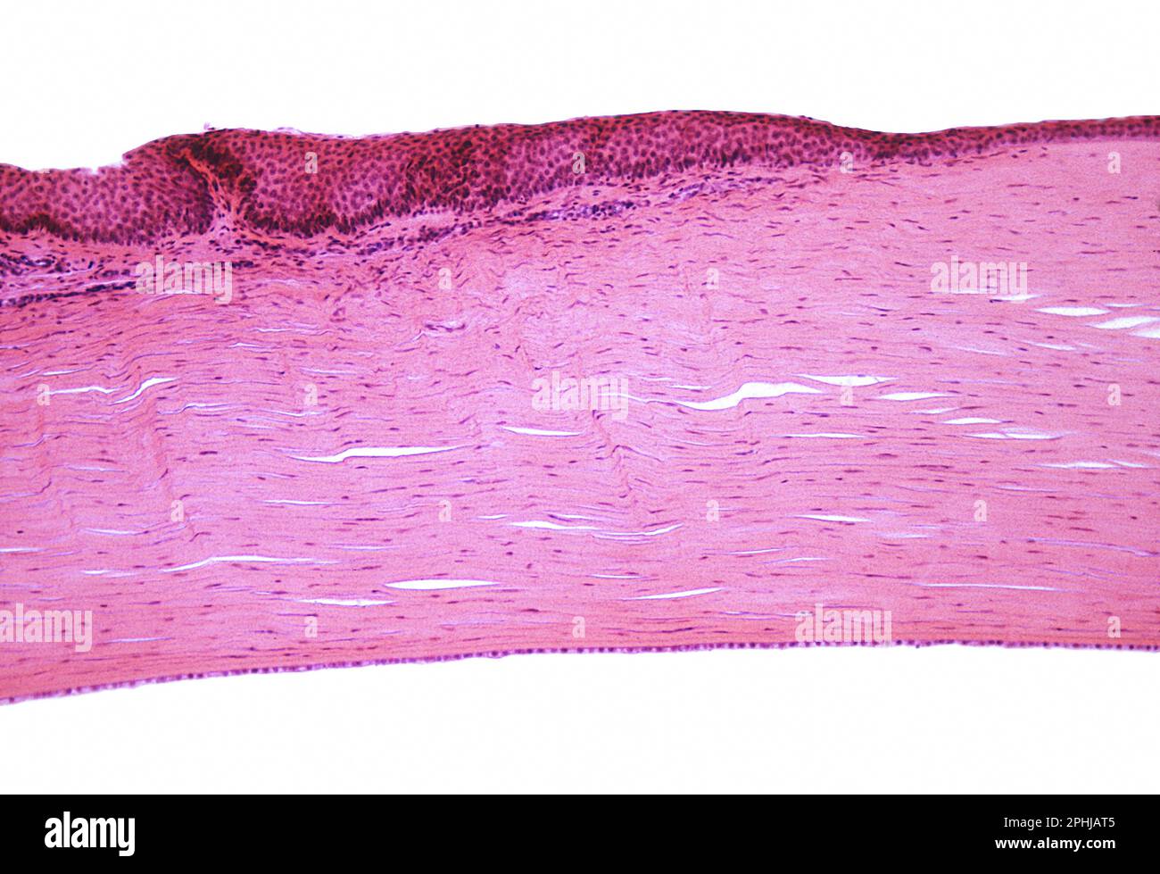 Human conjunctiva and cornea, light micrograph Stock Photo - Alamy