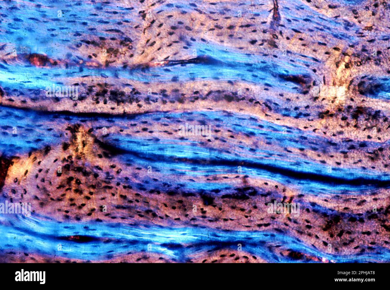 Compact bone, light micrograph Stock Photo - Alamy