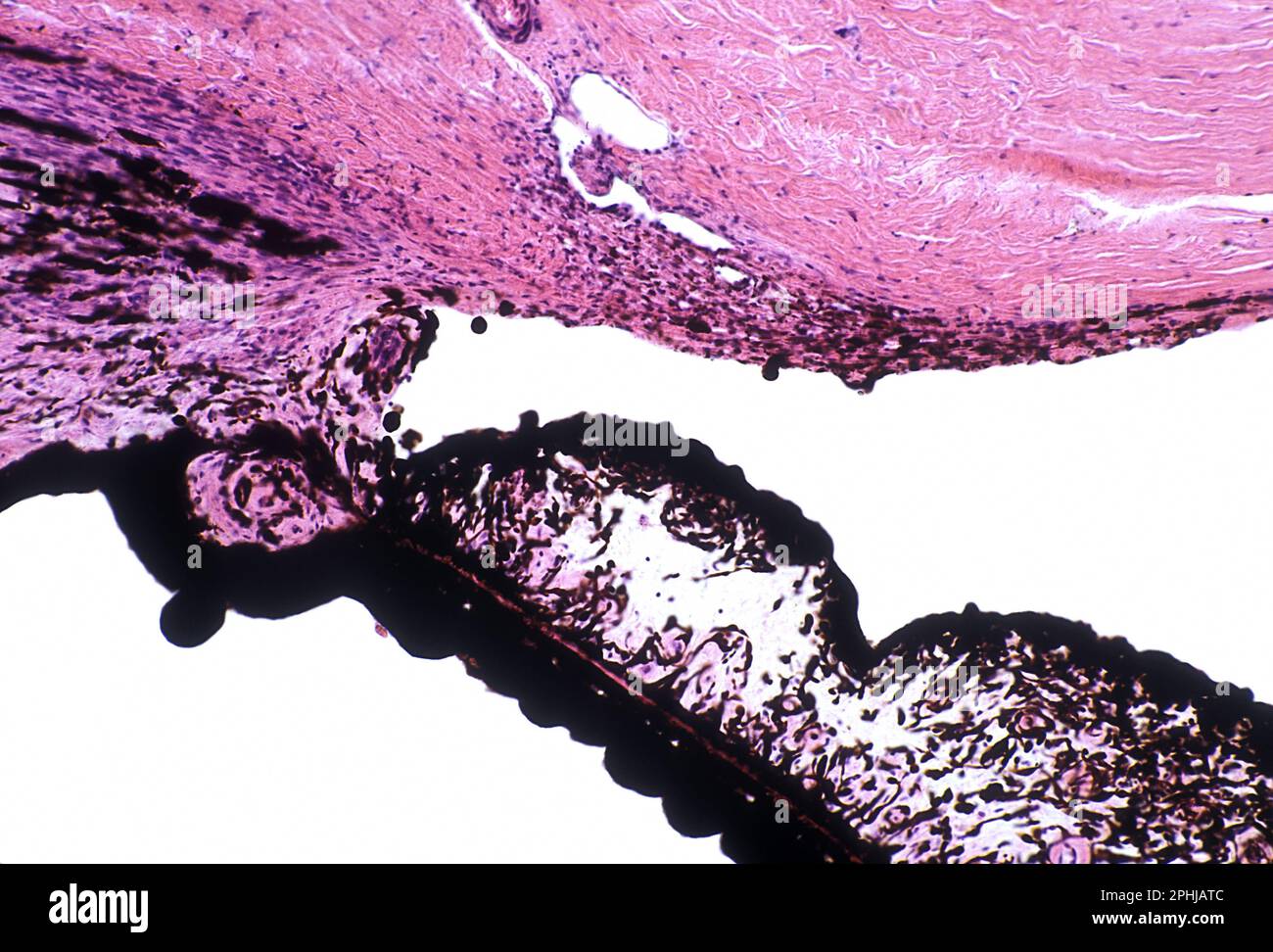 Schlemm canal in eye, light micrograph Stock Photo - Alamy