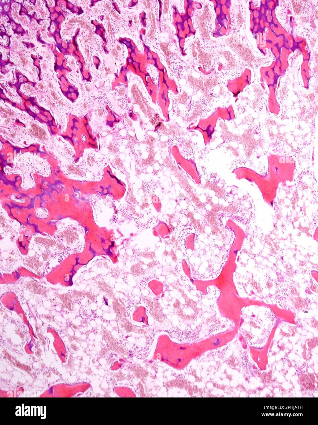 Endochondral ossification, light micrograph Stock Photo - Alamy