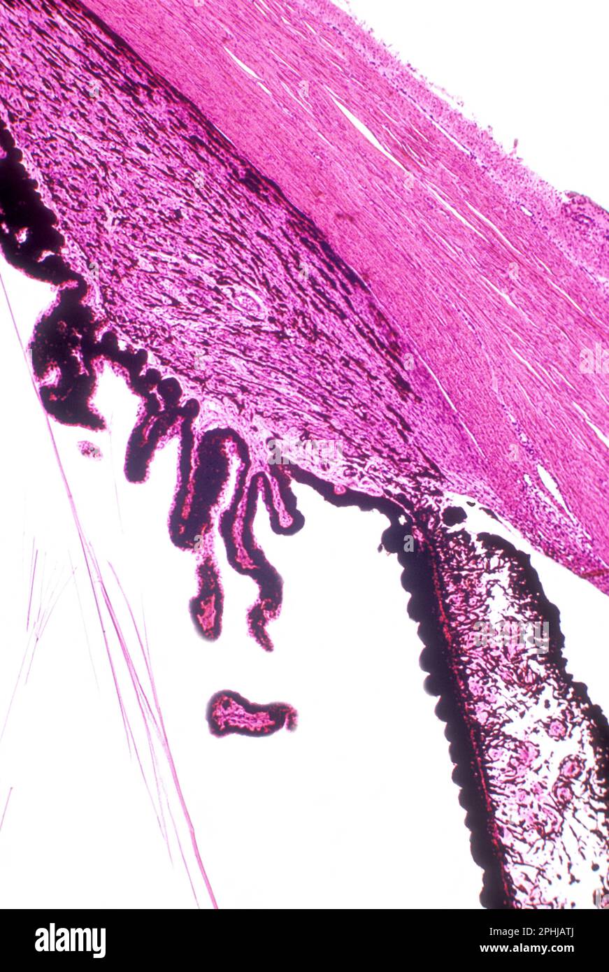 Human ciliary body and iris, light micrograph Stock Photo - Alamy