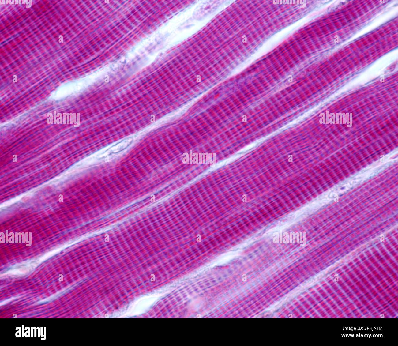 Striated muscle fibres, light micrograph Stock Photo - Alamy