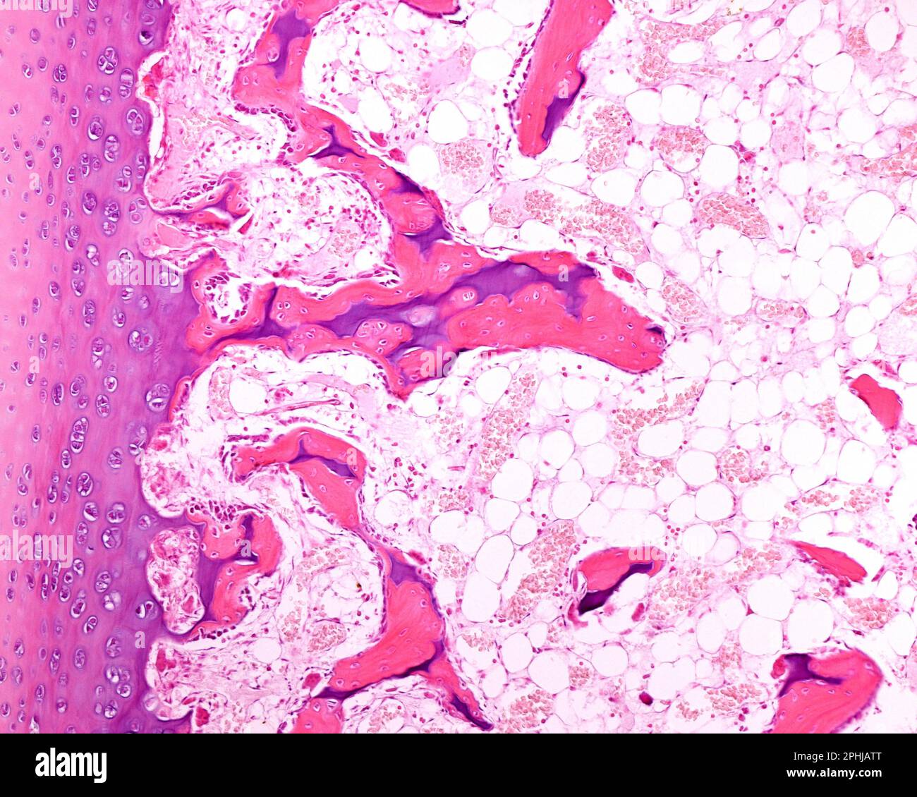 Developing bone, light micrograph Stock Photo - Alamy