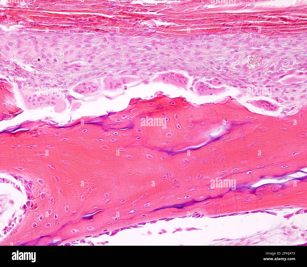Osteoclasts, light micrograph Stock Photo - Alamy