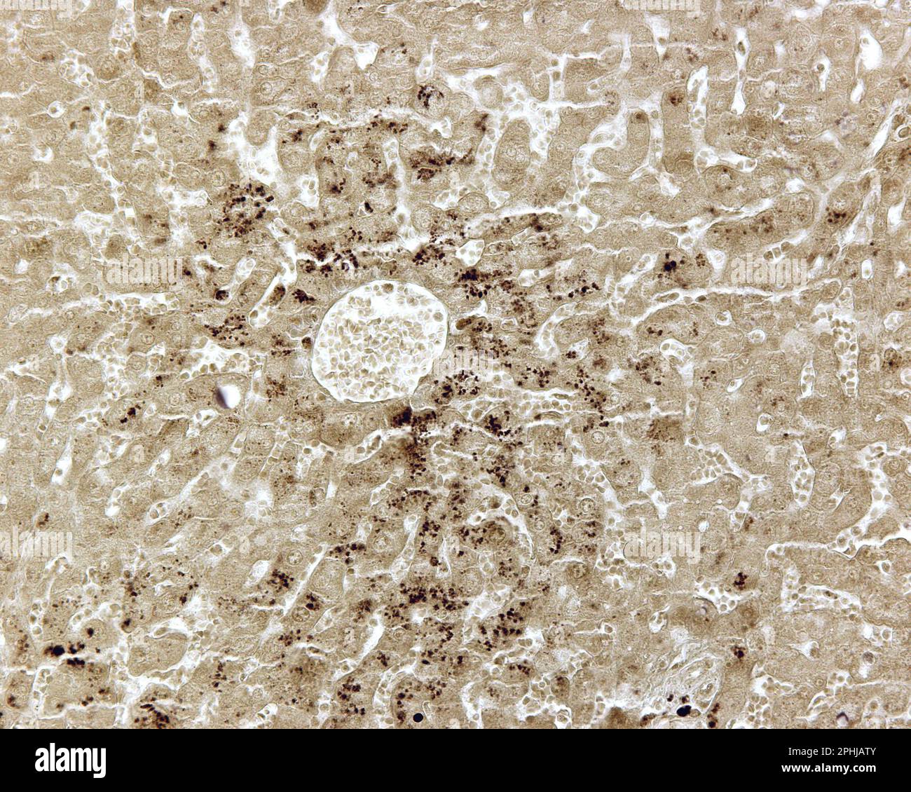 Lipid droplets in liver cells, light micrograph Stock Photo - Alamy