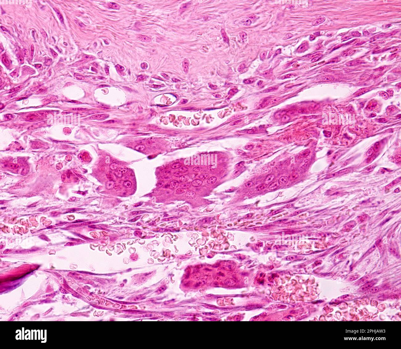 Osteoclasts, light micrograph Stock Photo - Alamy