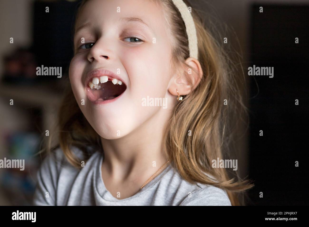 beautiful little girl of 6-7 years old lost the first milk tooth. Loss ...