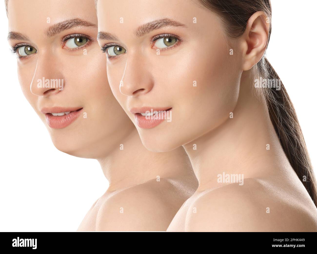 Double chin problem. Collage with photos of young woman before and ...