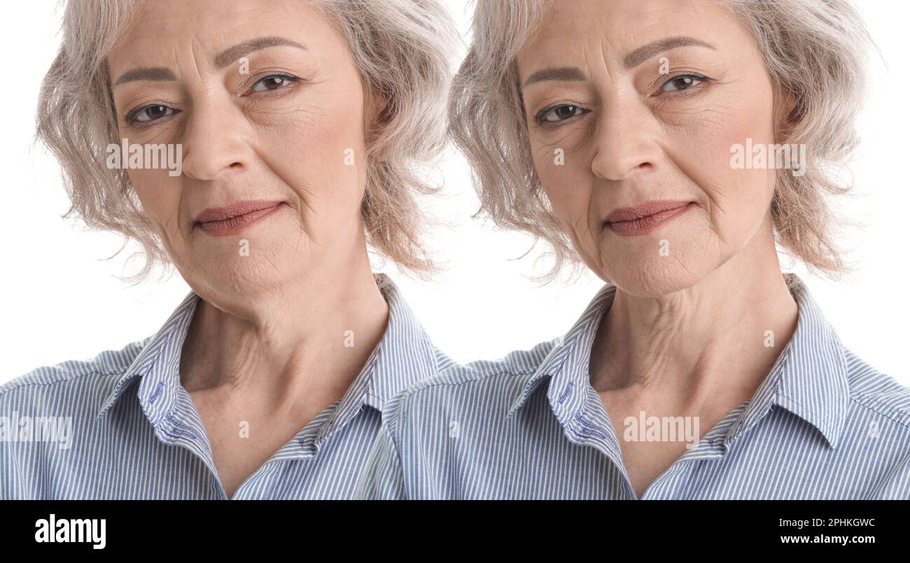 Double chin problem. Collage with photos of mature woman before and ...