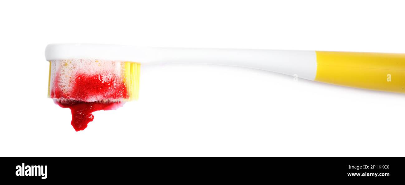 Toothbrush with paste and blood on white background, top view. Gum ...