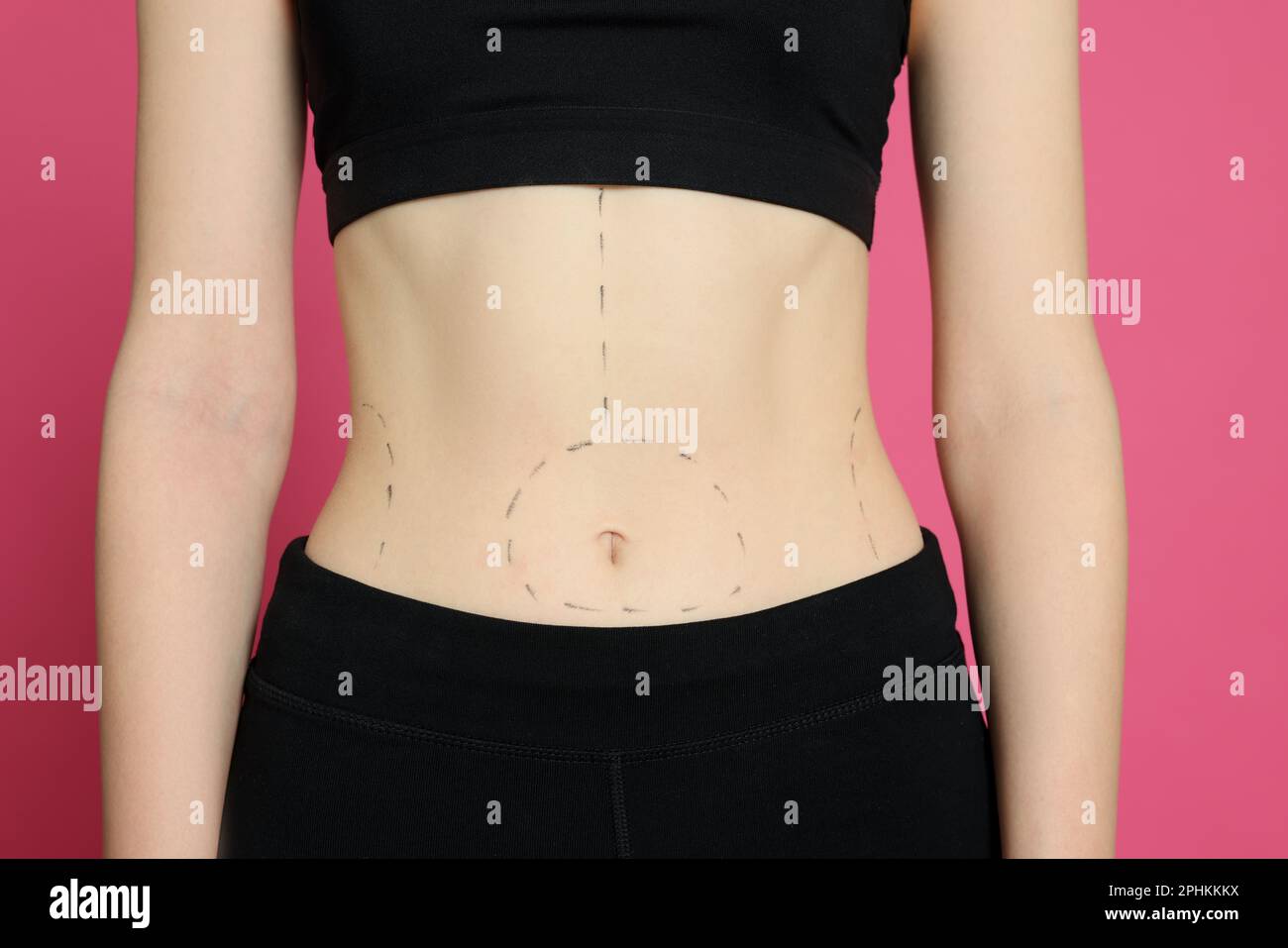Slim woman with marks on body against pink background, closeup. Weight ...