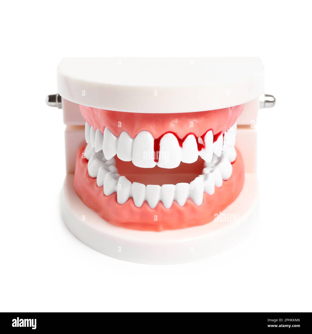 Model of jaw with blood on teeth against white background. Gum problems ...