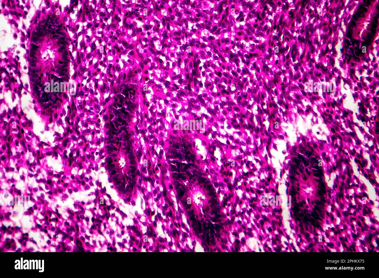 Lm light microscope hi-res stock photography and images - Alamy