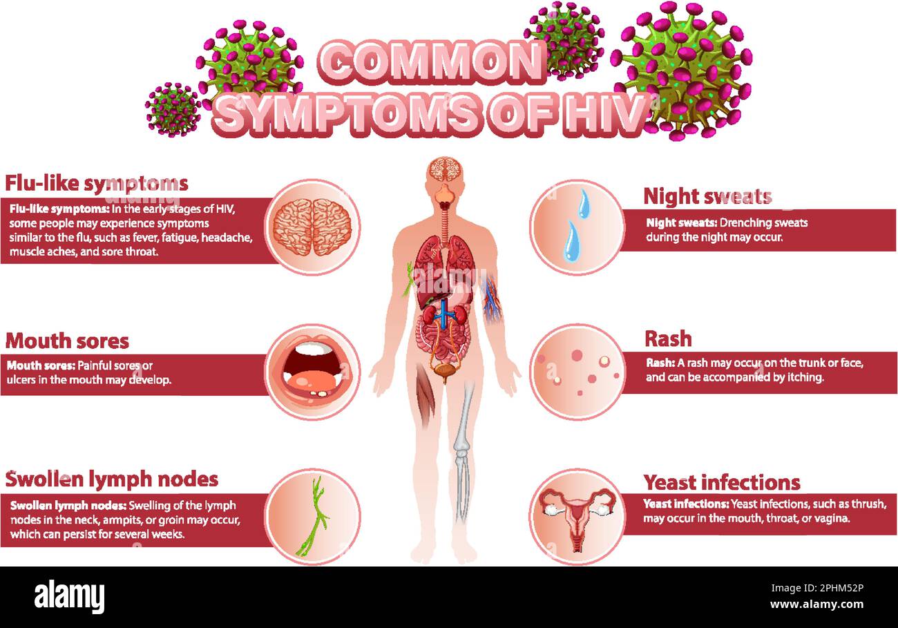 Informative poster of common symptoms of HIV illustration Stock Vector ...