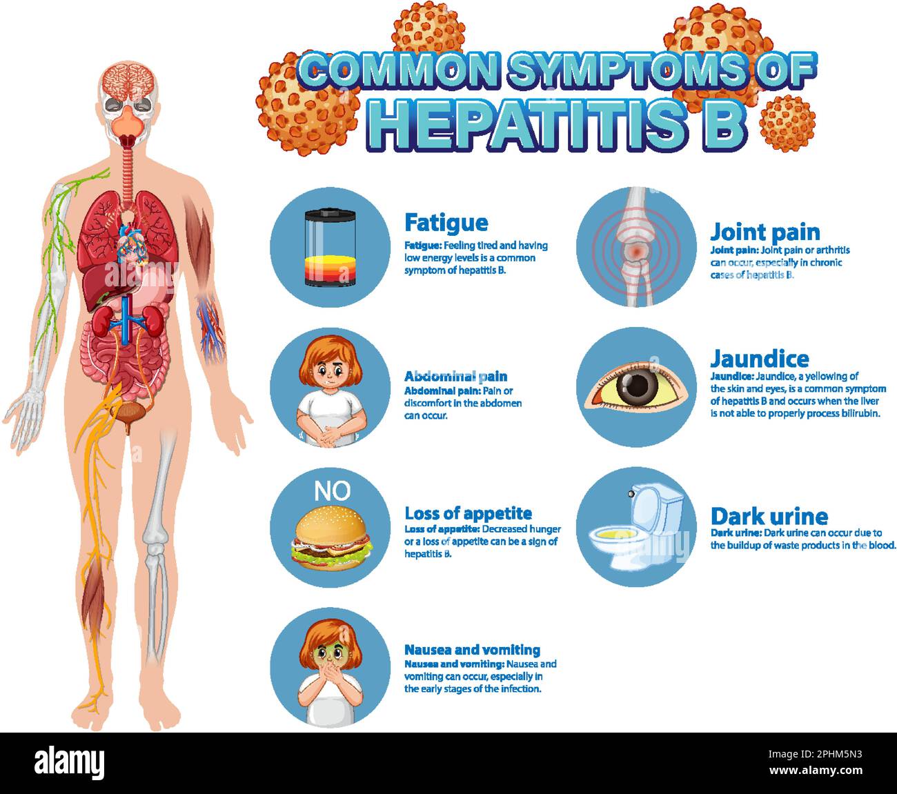 Informative poster of common symptoms Hepatitis B illustration Stock Vector Image & Art - Alamy