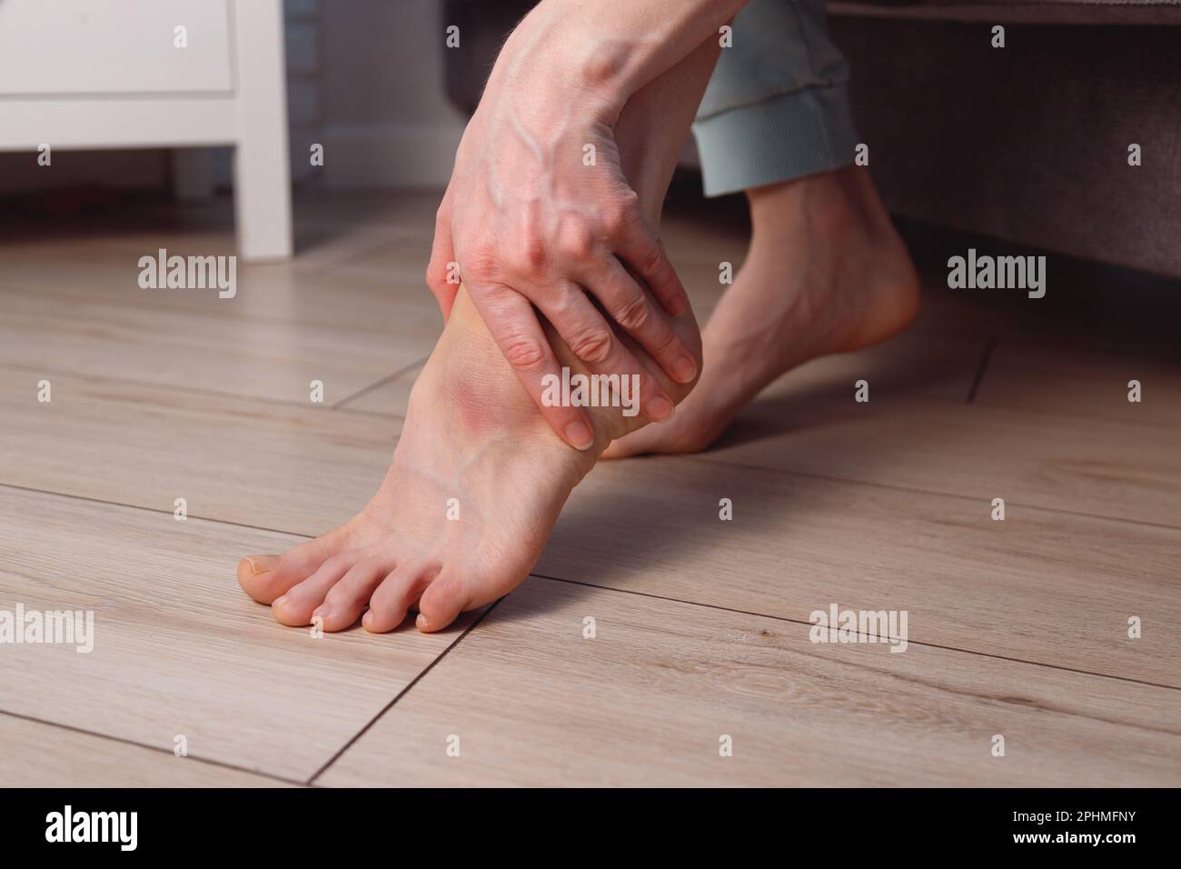 Woman apply ointment on ankle with bruise and swelling on her foot at ...