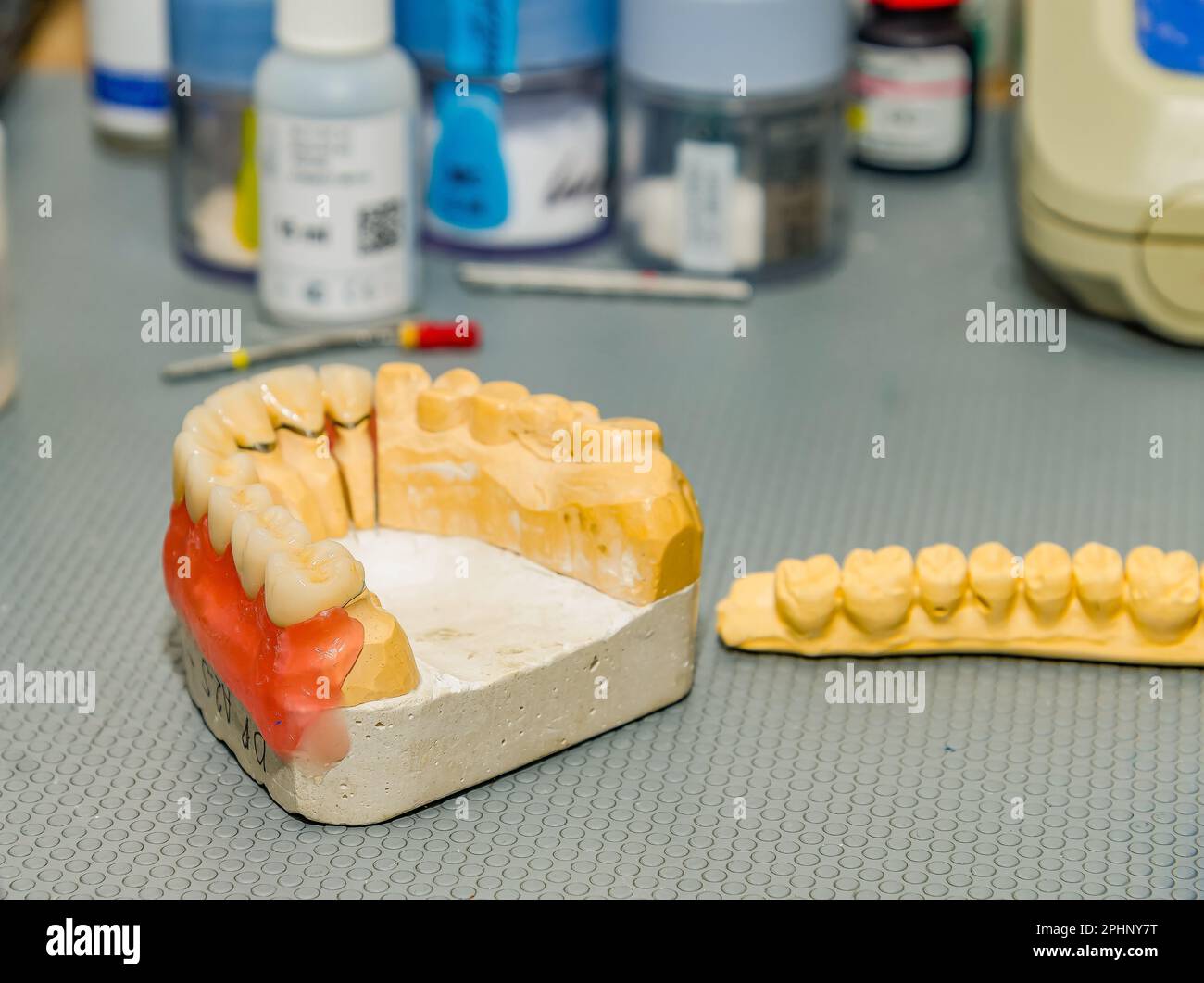 Plaster cast of the jaw in office of a dental technician Stock Photo ...