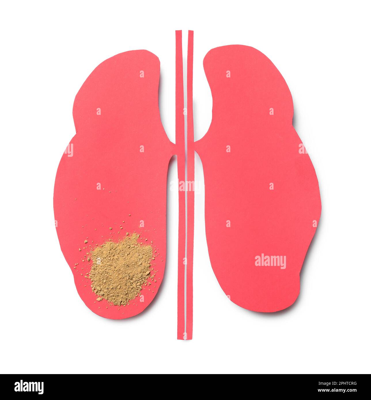 Paper cutout with sand on white background, top view. Kidney stone ...