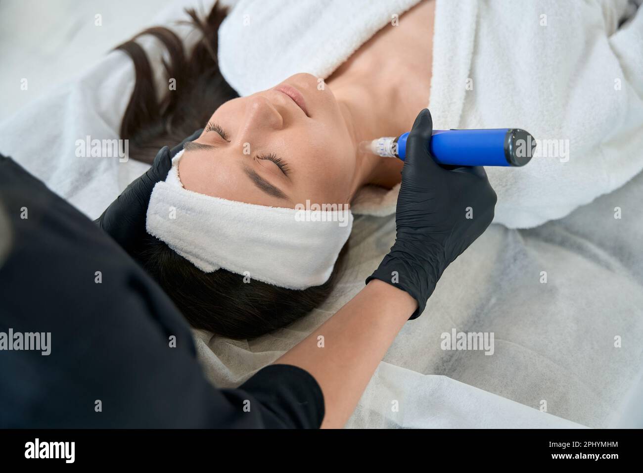 Dermatologist holding device and doing skin resurfacing procedure Stock ...