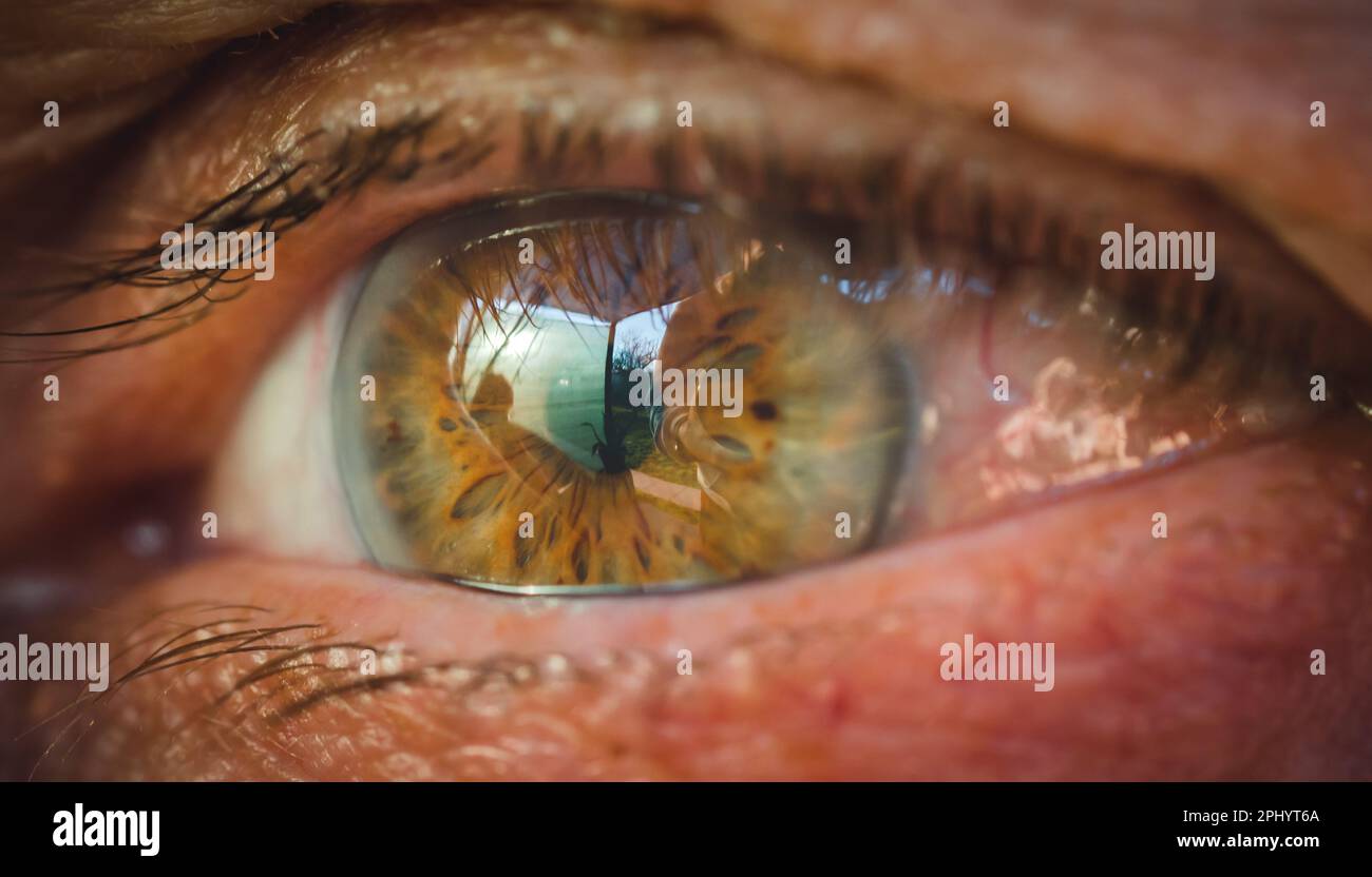 A close-up of a human eye with a striking combination of brown, yellow ...