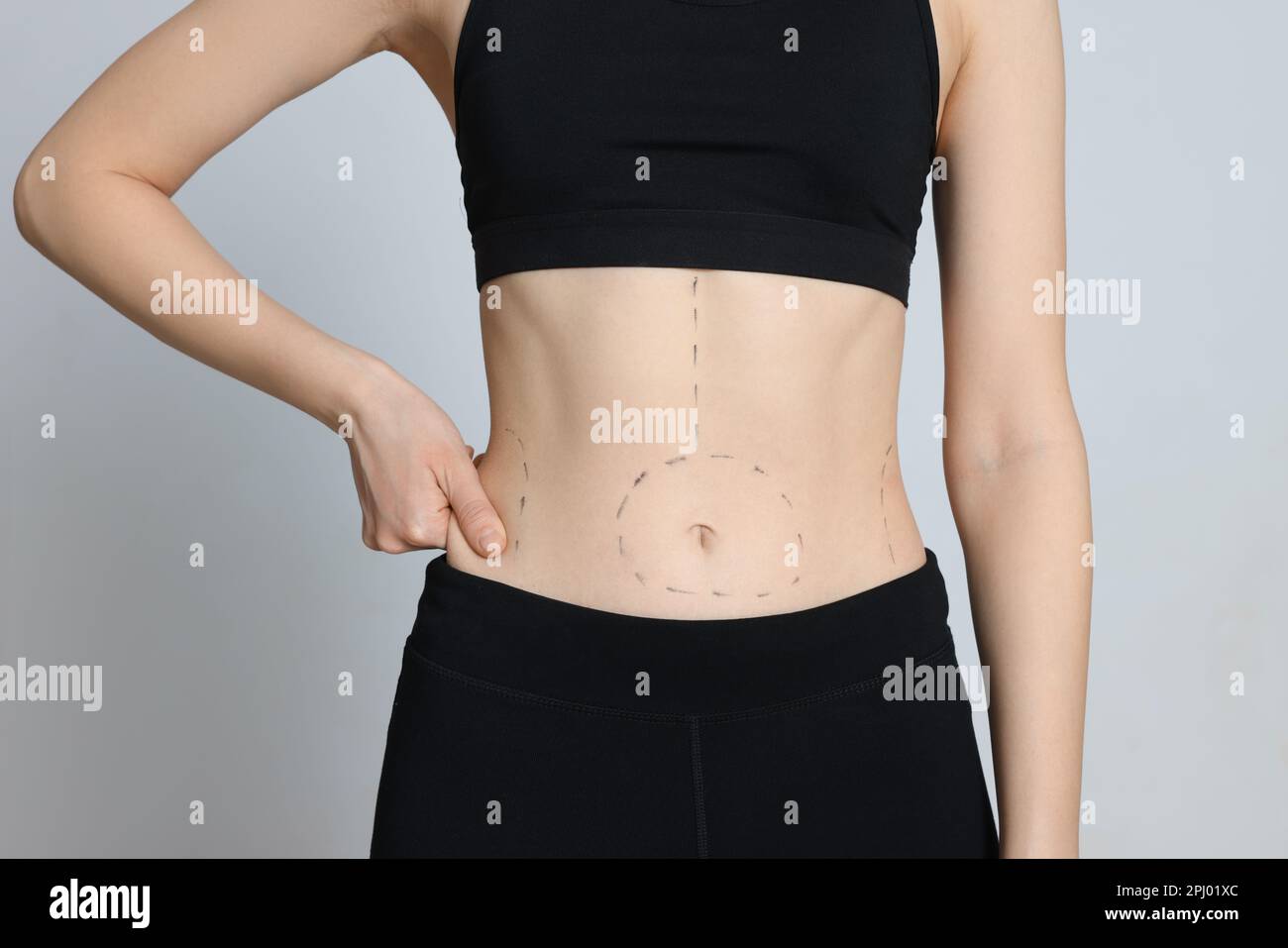 Slim woman with marks on body against light background, closeup. Weight ...