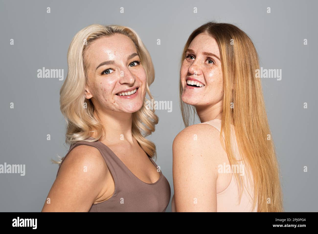 cheerful models with freckles and acne smiling isolated on grey,stock ...