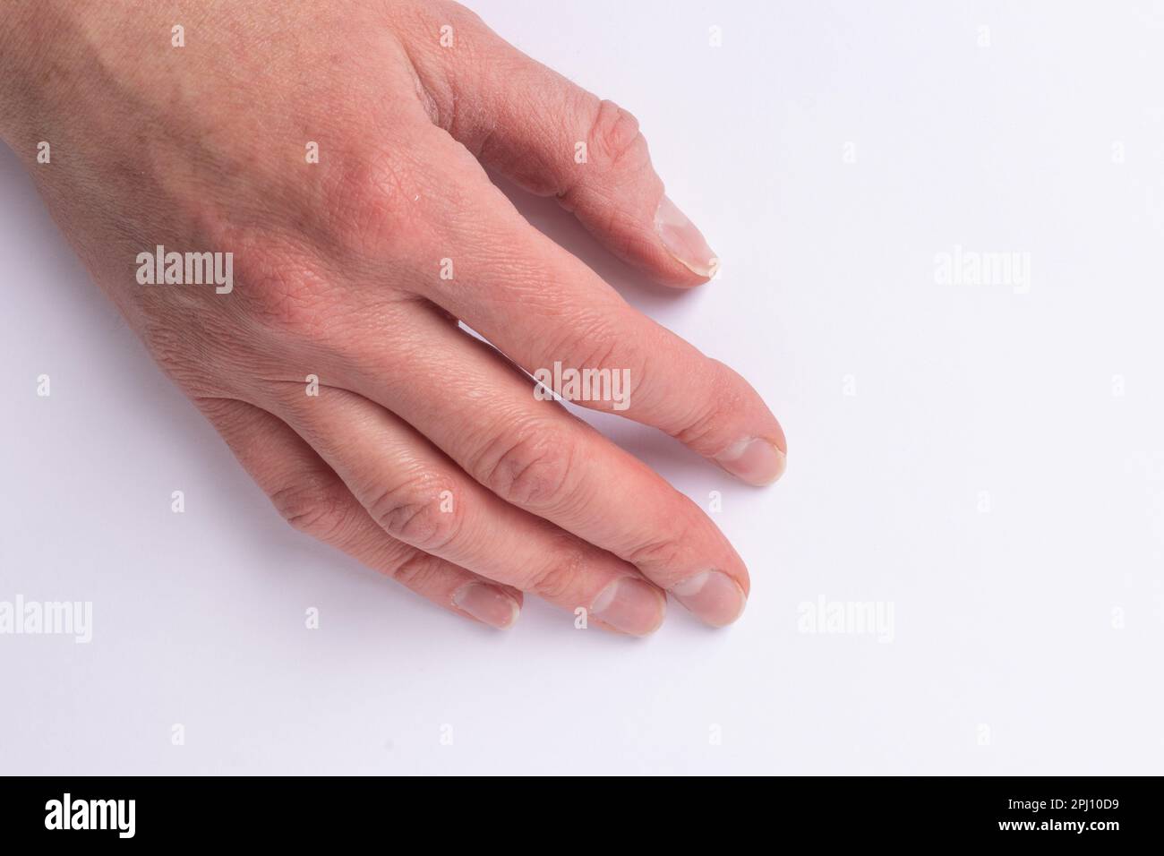 Close-up of female age-related hands with natural broken unhealthy ...