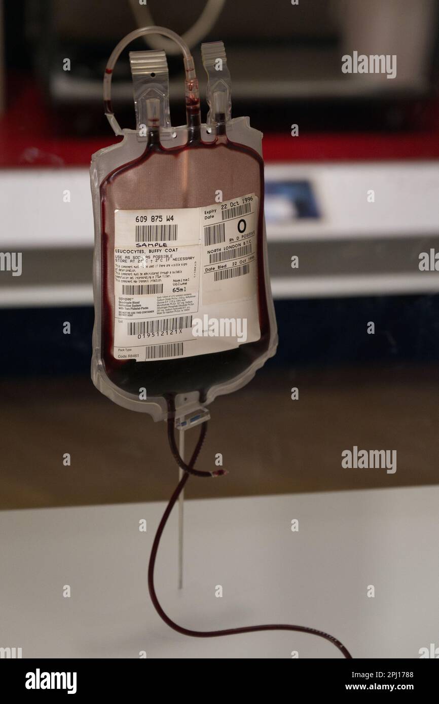 A unit of blood from a blood donation Stock Photo - Alamy