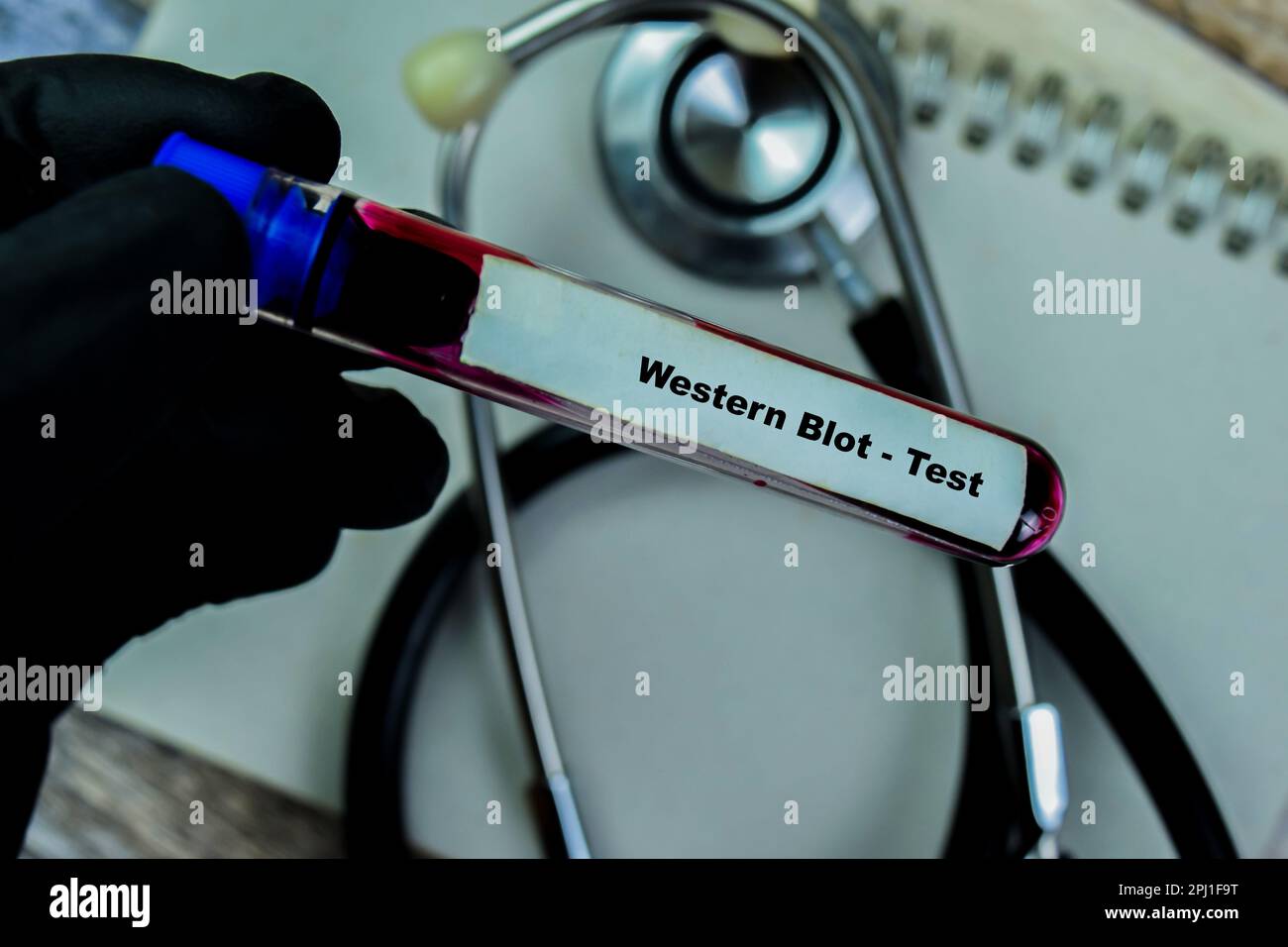 Concept of Western Blot - Test with blood sample. Healthcare or medical ...
