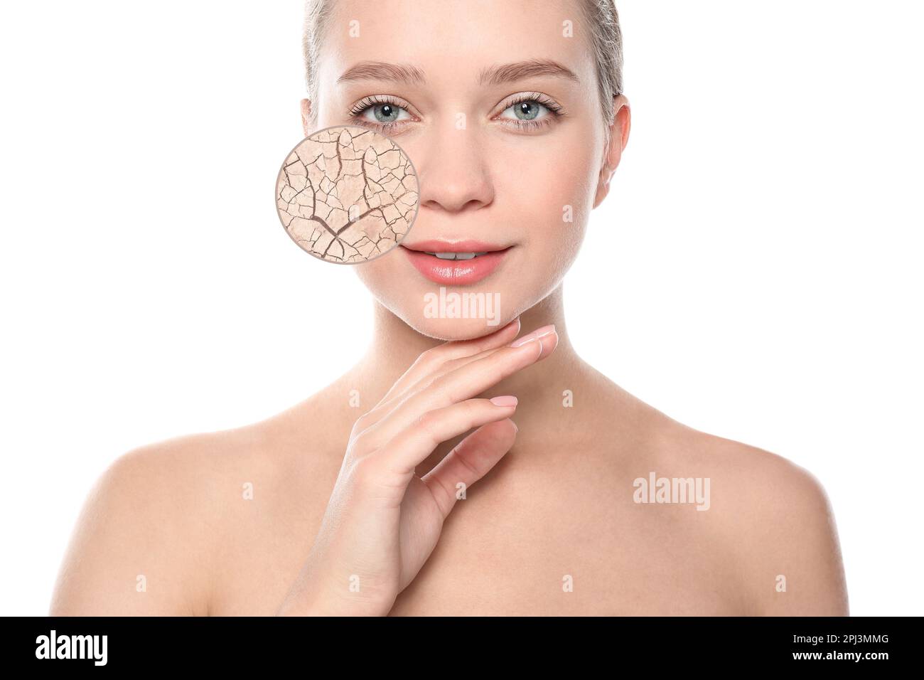 Young woman with facial dry skin problem on white background Stock ...