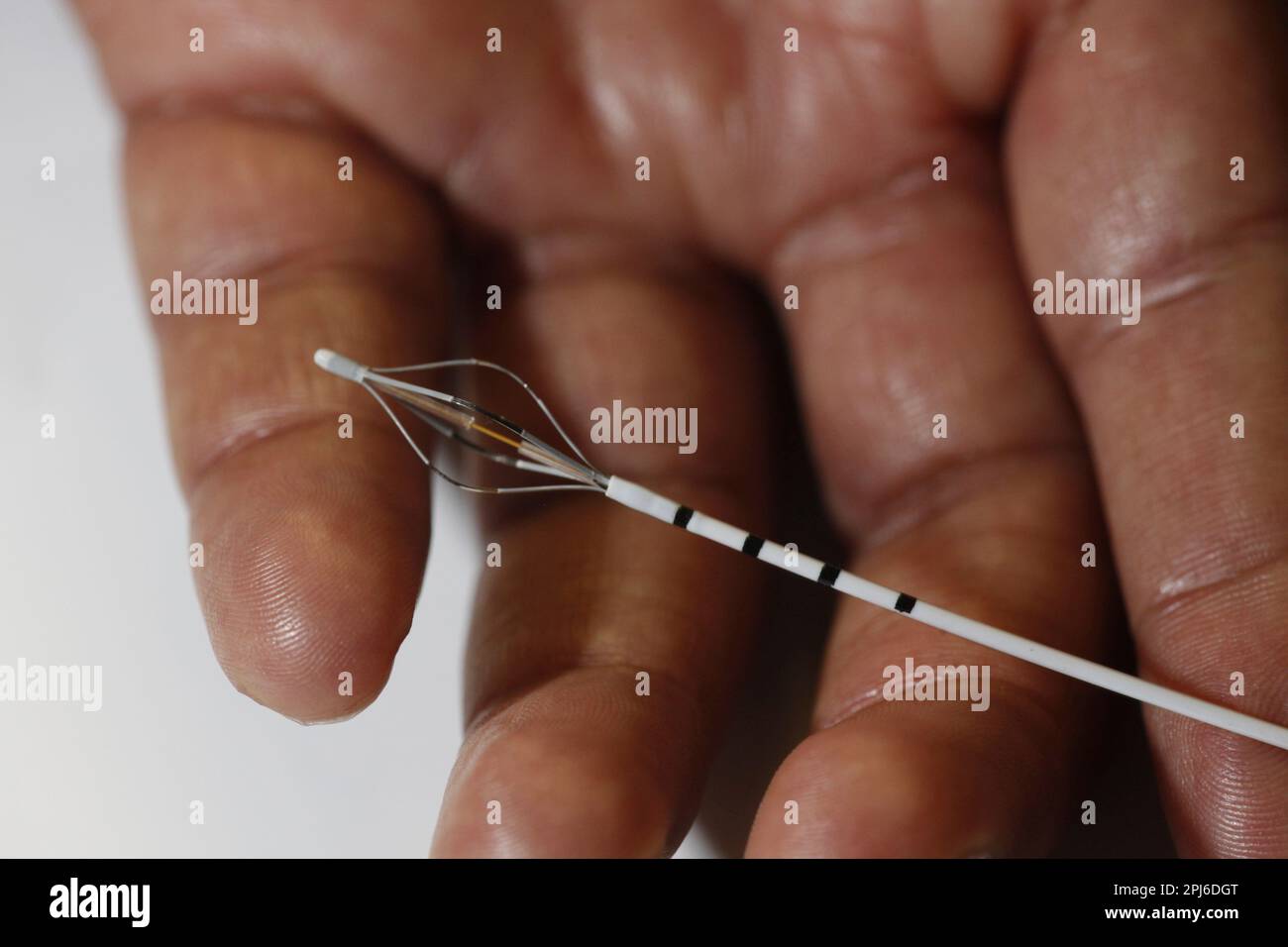 Dr. Ganesh Krishna (l to r), interventional pulmonologist, displays the ...