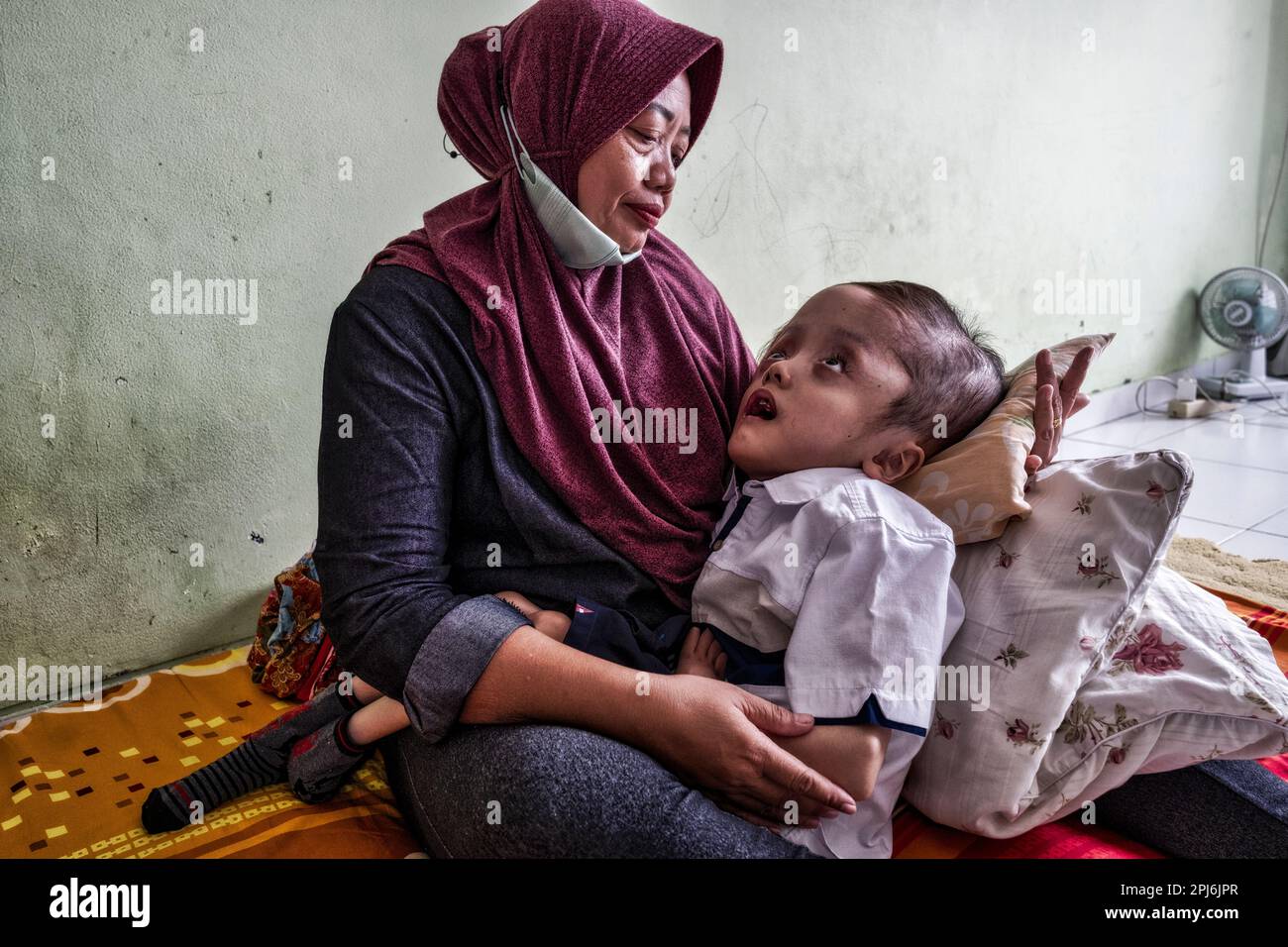 Hydrocephalus in indonesia hi-res stock photography and images - Alamy