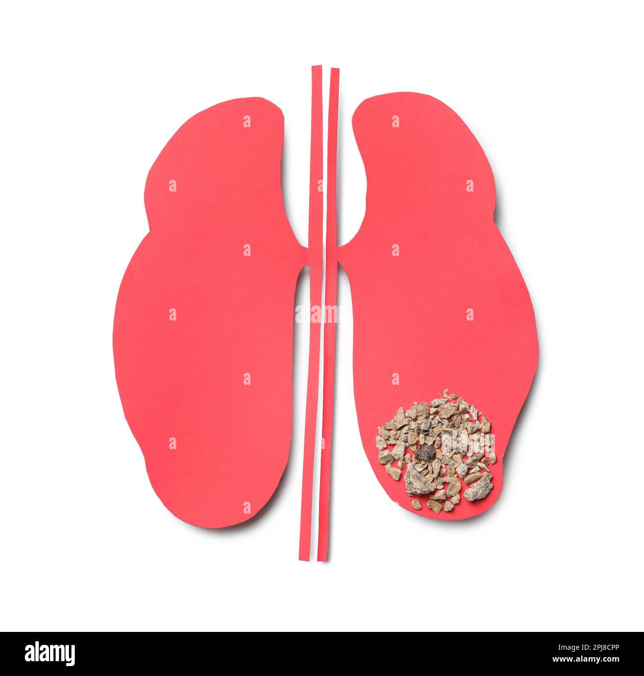 Paper cutout with stones on white background, top view. Kidney stone ...