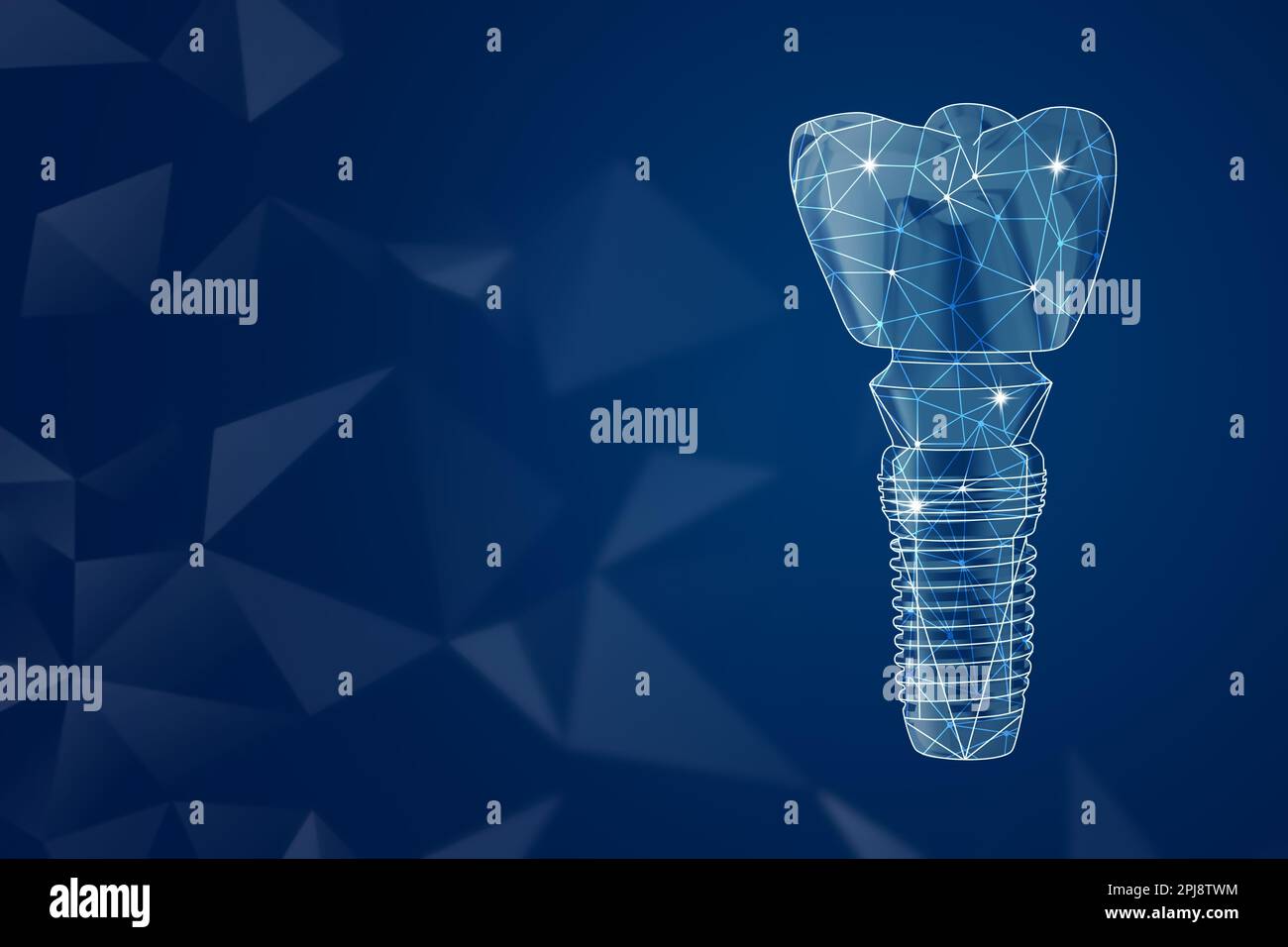 Illustration of dental implant on dark blue background. Space for text ...