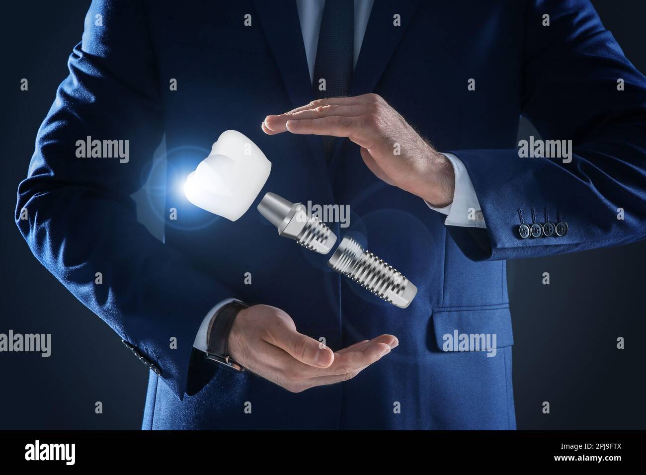 Idea implantation hi-res stock photography and images - Alamy