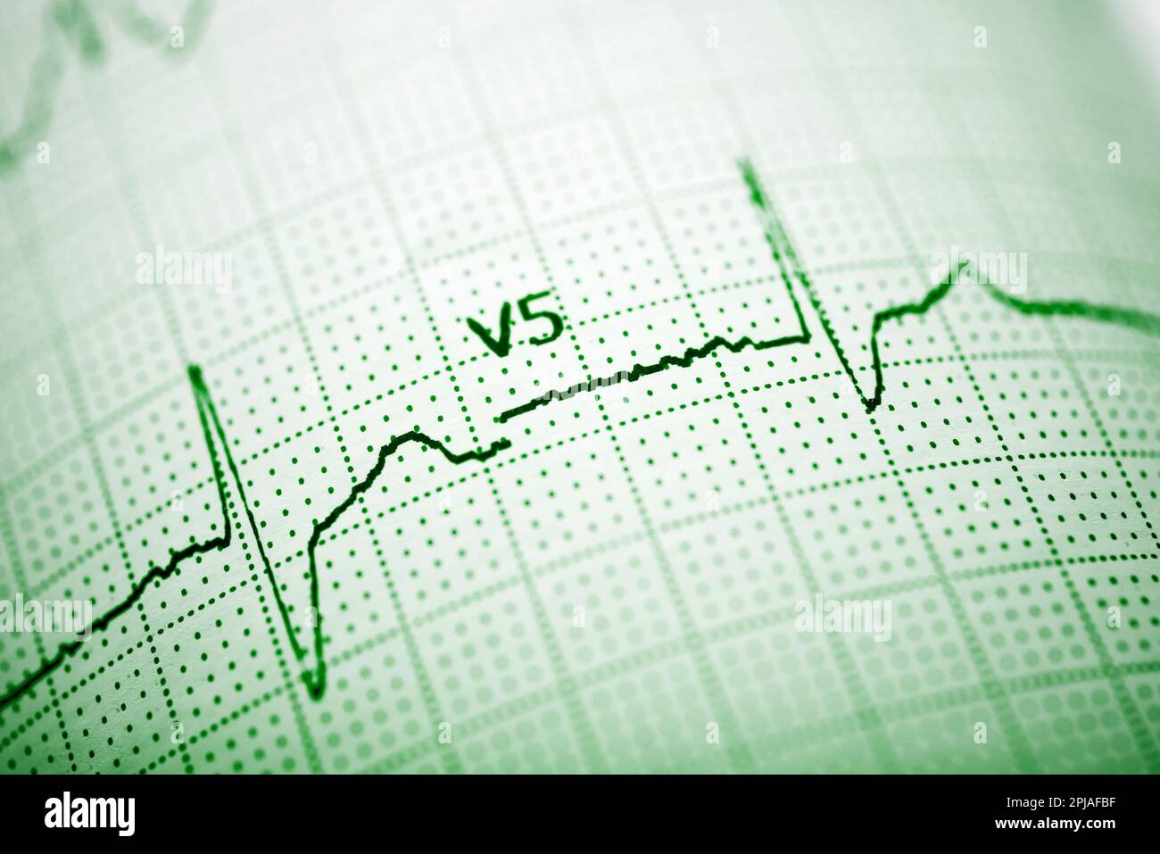 Electrocardiogram showing the pulse of the human heart Stock Photo - Alamy