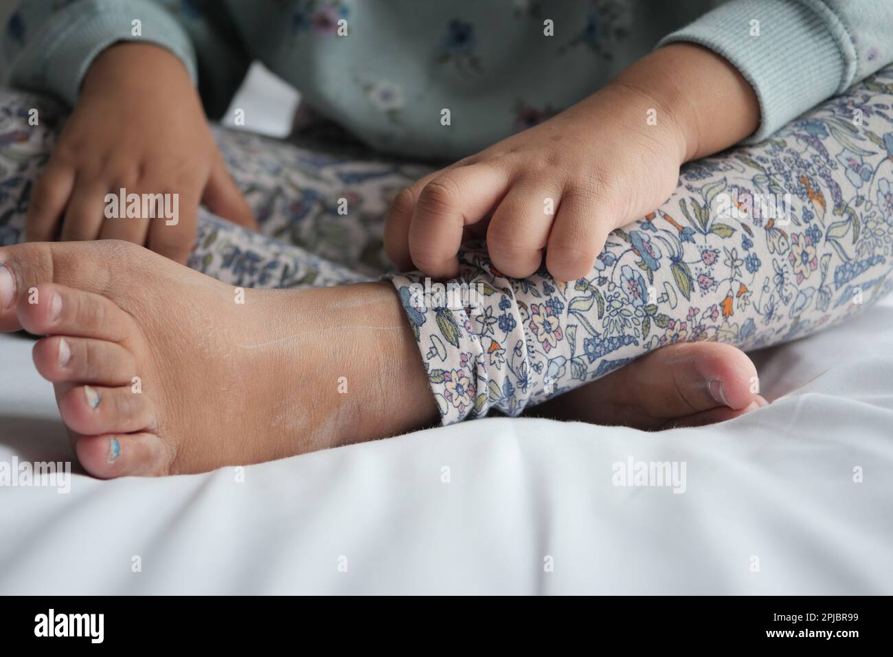 Child suffering from itching skin hi-res stock photography and images ...