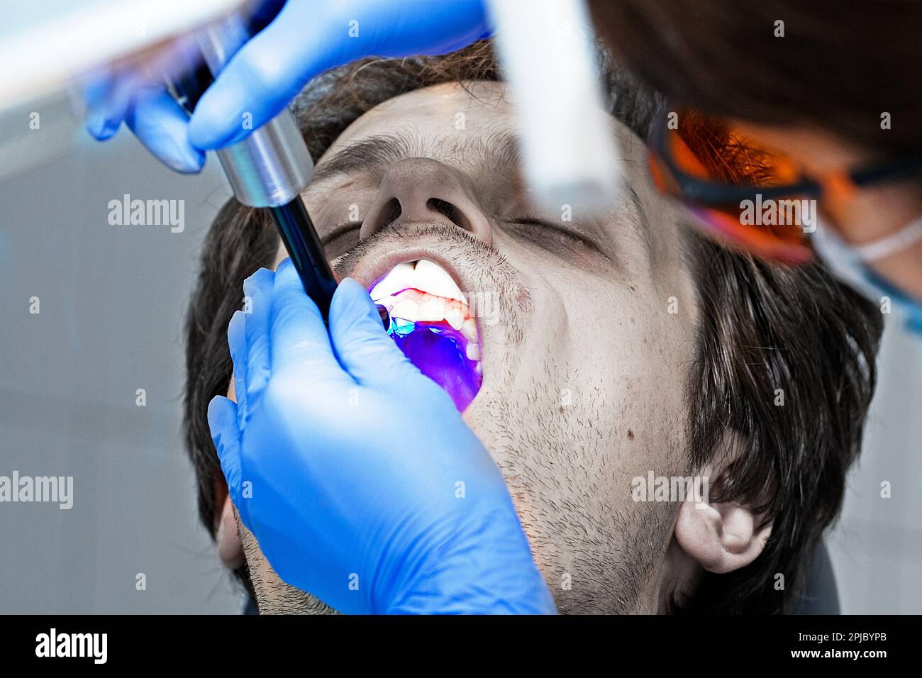 dentist treats the front teeth to the patient Stock Photo - Alamy