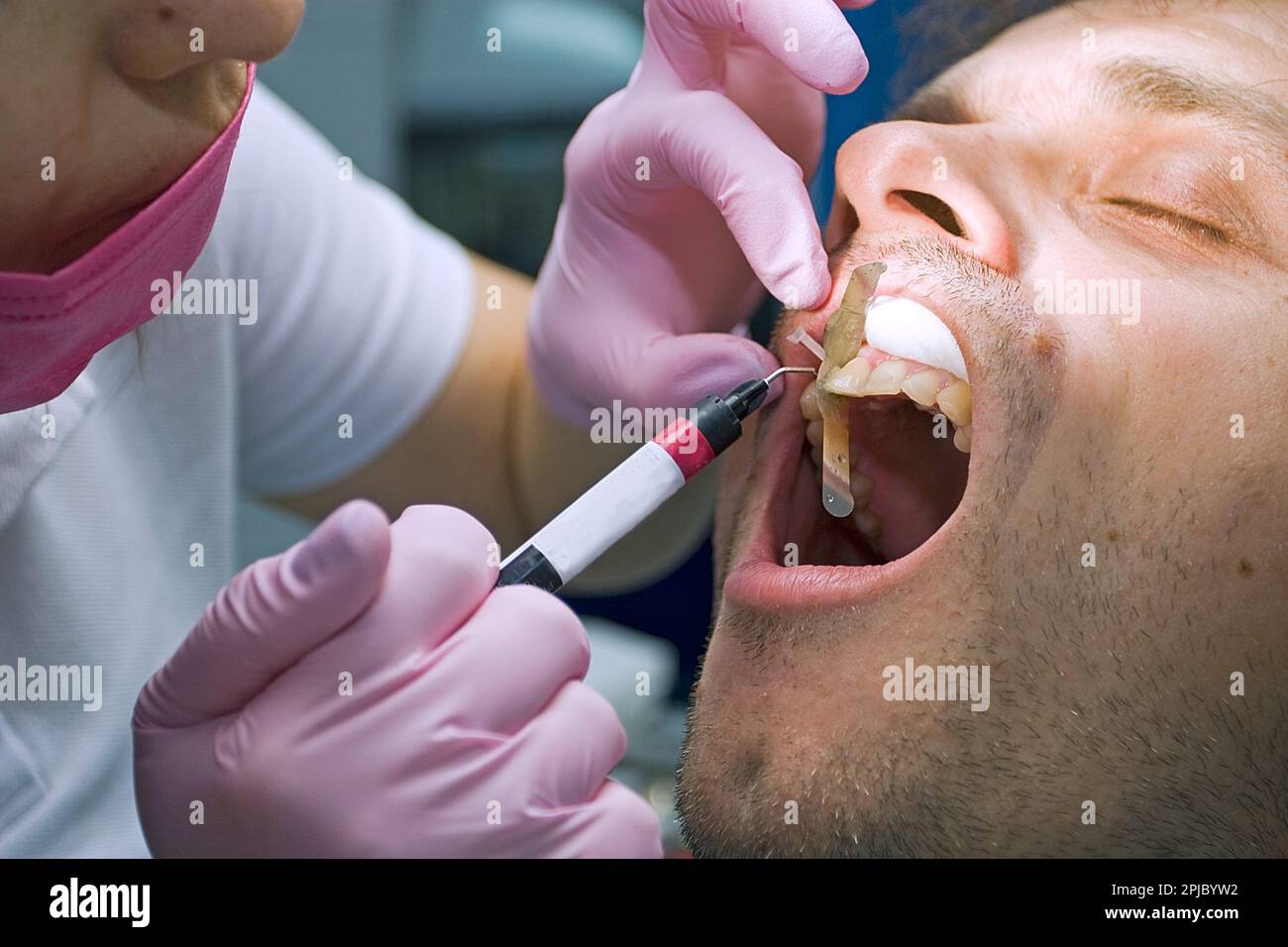 Paradantosis hi-res stock photography and images - Alamy