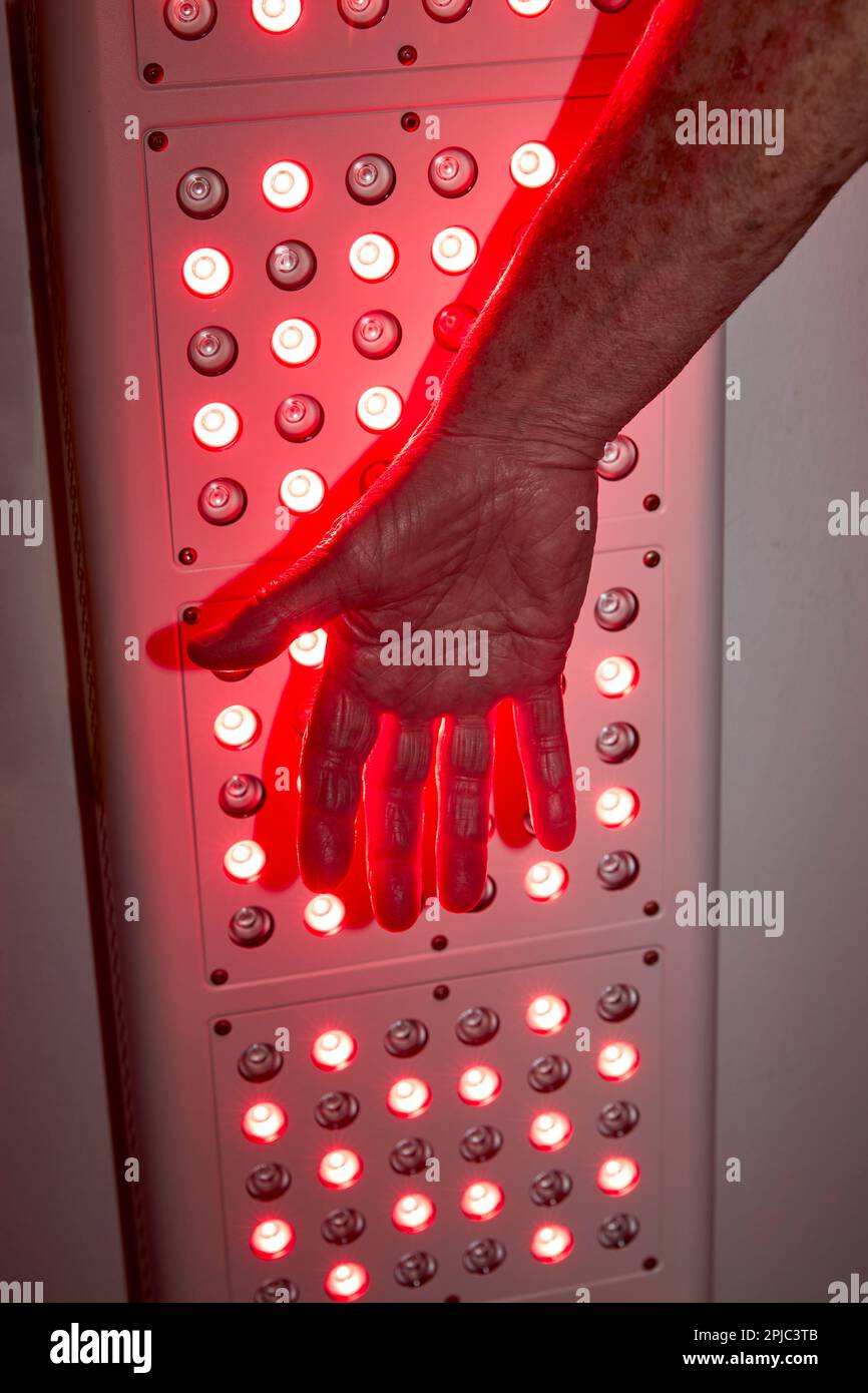 Far Infared Light Therapy on the Arm and Hand Stock Photo - Alamy